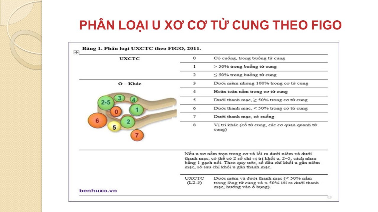 Cập nhật phương pháp thuyên tắc động mạch tử cung trong điều trị u xơ cơ tử cung và xử trí chửa ...